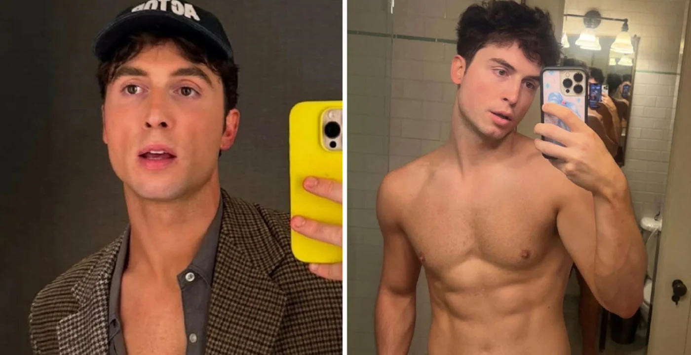 Benny in Overcompensating: chi è l'attore Benito Skinner